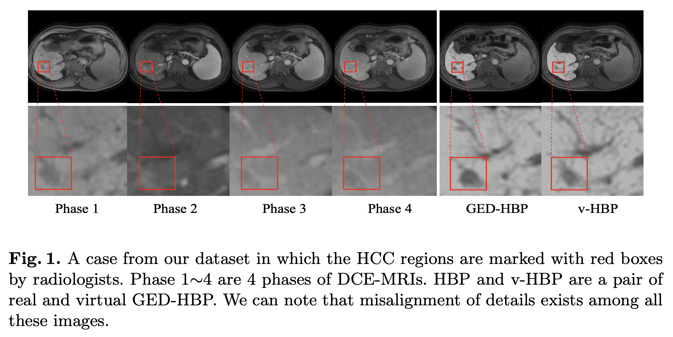 GitHub - liujiyaoFDU/MrGAN: Multi-Phase Liver-Specific DCE-MRI ...